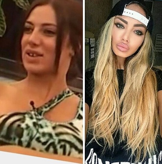 Ovako je Soraja izgledala prije plastičnih operacija - CdM Ovako je Soraja izgledala prije plastičnih operacija - CdM