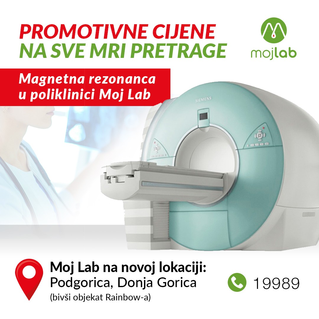 Najnovija Siemens magnetna rezonanca u Poliklinici Moj Lab: Promotivne ...